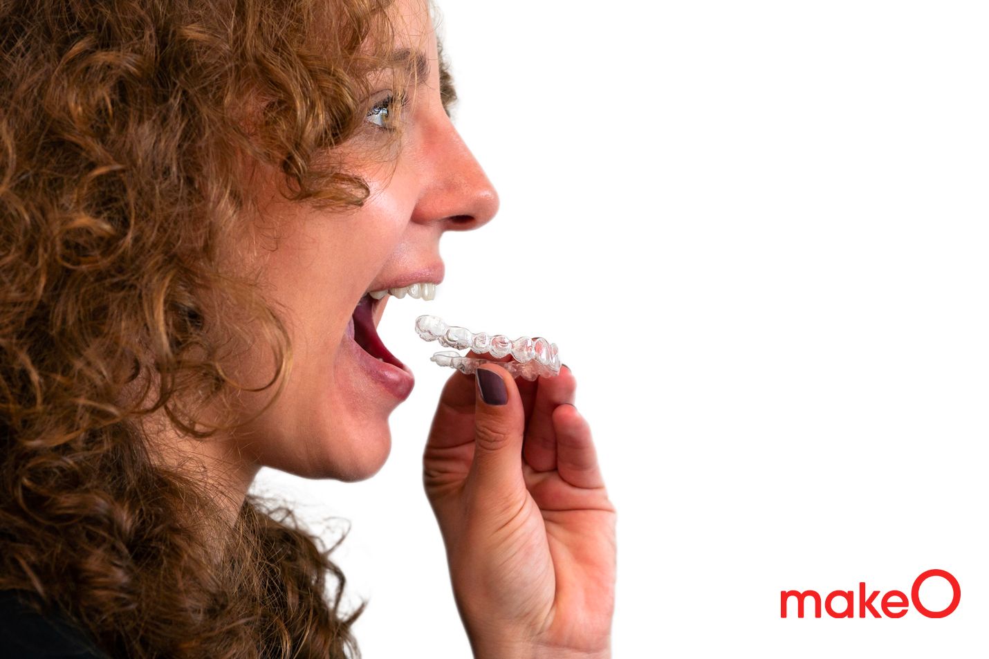 Traditional Retainers Vs Clear Retainers : Which One to Choose?