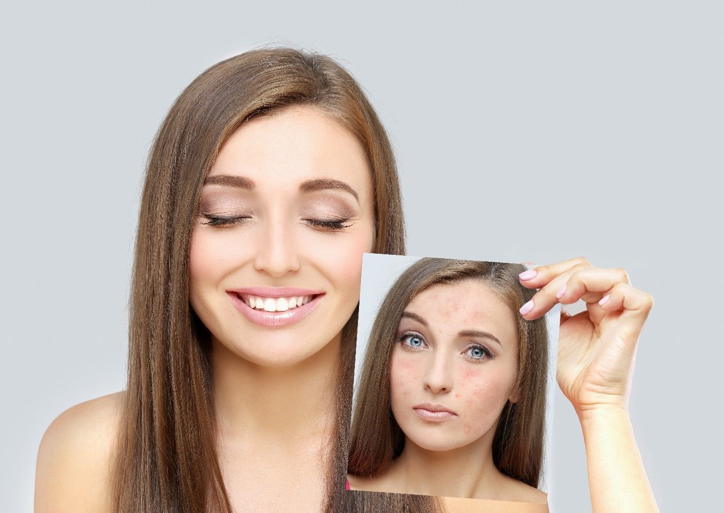 Sick Of Pimple Scars Find Out How To Get Rid Of Them Makeo Skinnsi