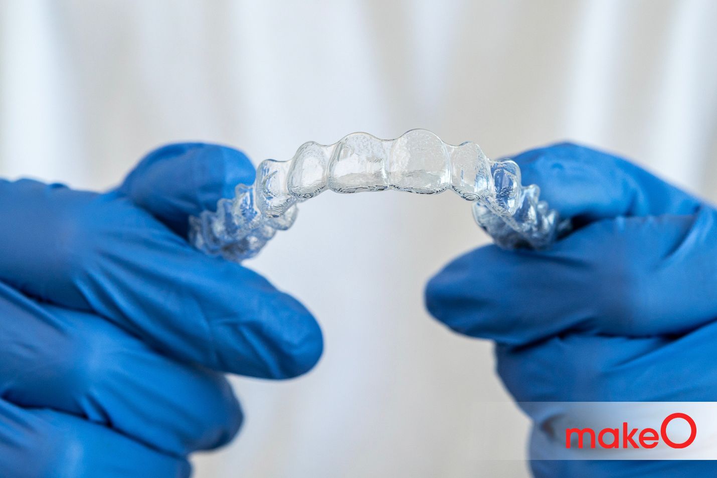 Braces and Tooth Extraction: A Complete Overview